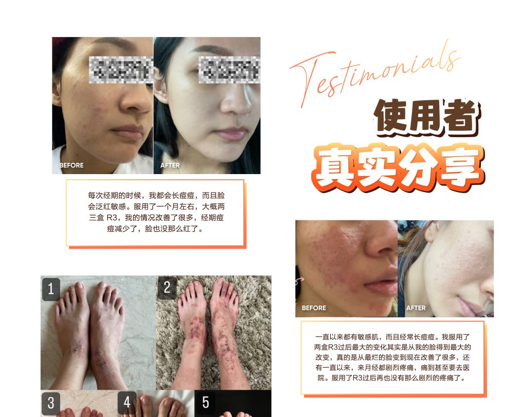 产品 - R3 - Chevin